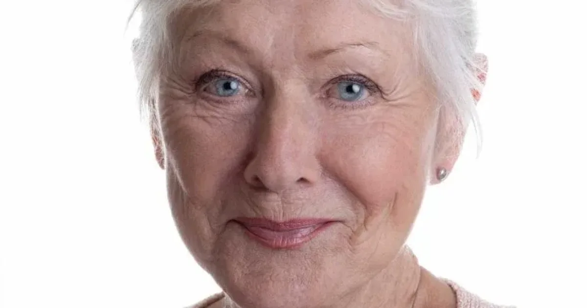 Carole Anne - Female | PHA